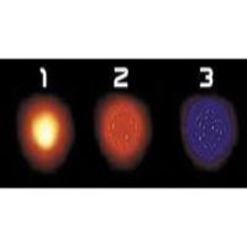 Fosfenos - La audioteca de El Explicador - Podcast en iVoox