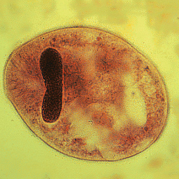 Balantidium coli. - Taller de Investigación. - Podcast en iVoox