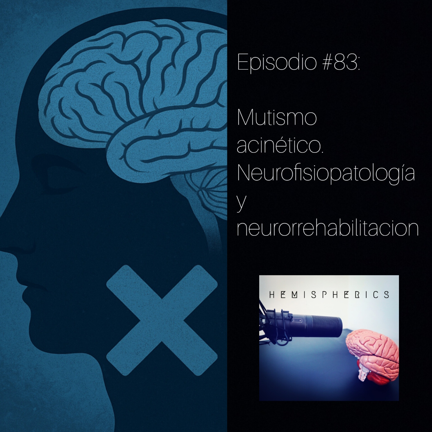 #83: Mutismo acinético. Neurofisiopatología y neurorrehabilitación ...