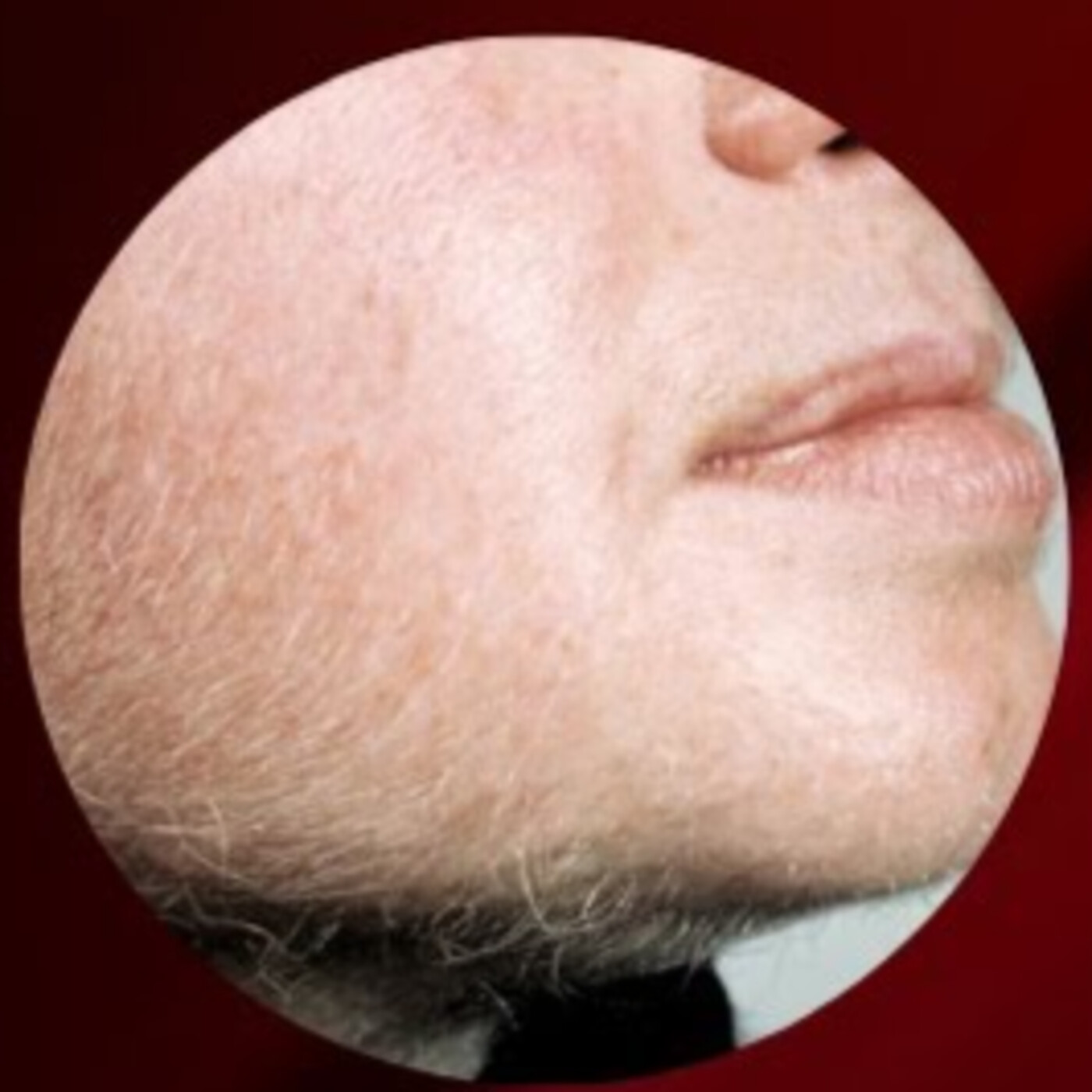 How to stop facial hair growth on the upper lip, the sides chin or the ...