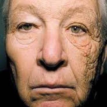 "Anatoli Bugorski y el acelerador de partículas" Basstiles - Tamamasla ...